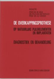 BSL Shop | De overkappingsprothese op natuurlijke pijlerelementen en ...